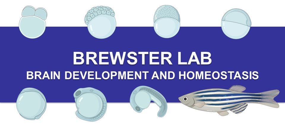 Welcome to the Brewster Lab! – UMBC
